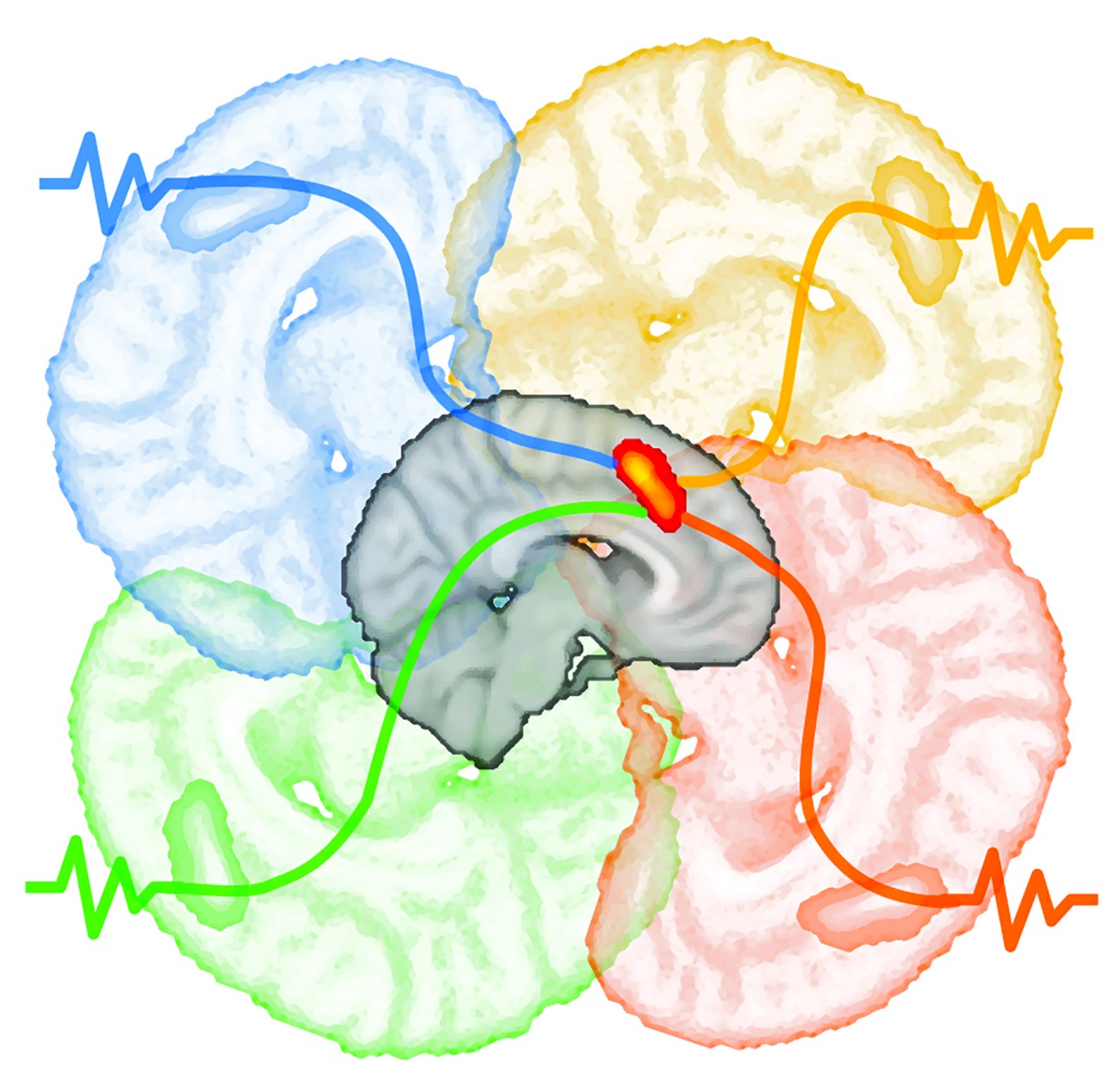 Cognitive neuroscience | Paris Brain Institute