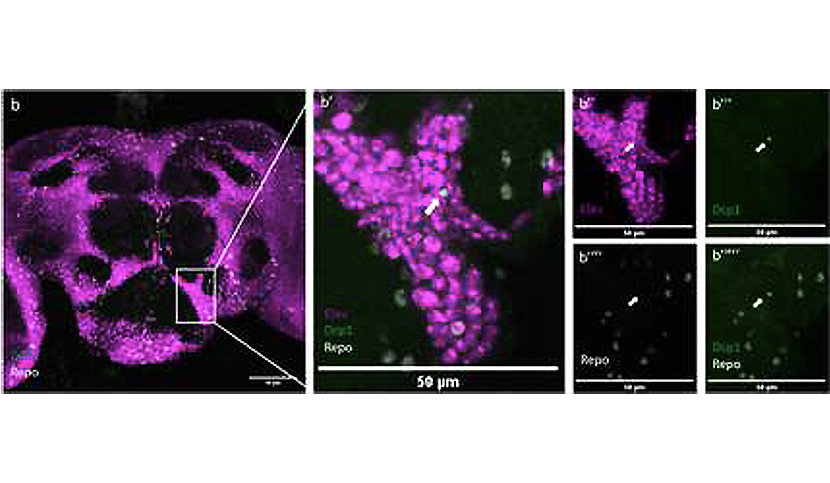New insights on a major protein involved in Alzheimer’s disease | Paris ...