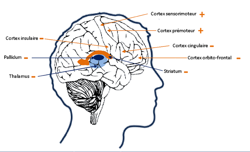 What are the biological mechanisms of Tourette’s syndrome? | Paris ...