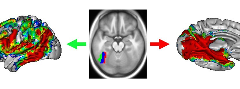 Brain, reading and writing | Paris Brain Institute