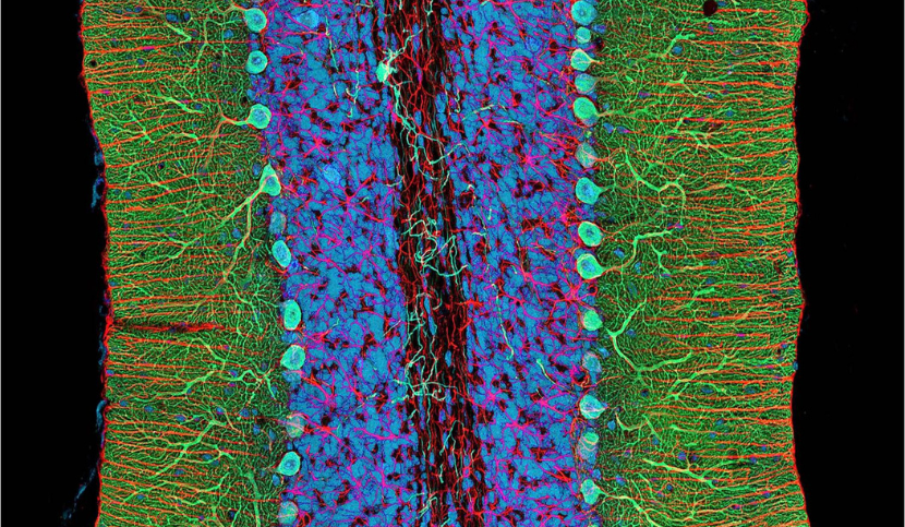 NeuroGen: Brain development and dysfunction in neurogenetic diseases ...