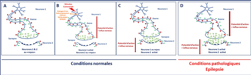 What are the biological mechanisms of epilepsy? | Paris Brain Institute