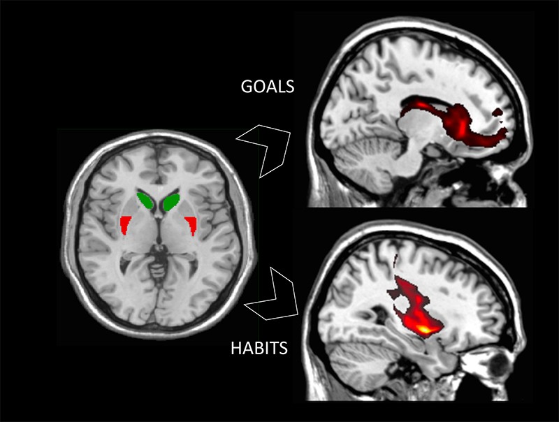 Tourette's syndrome: tics, a bad habit ? | Paris Brain Institute