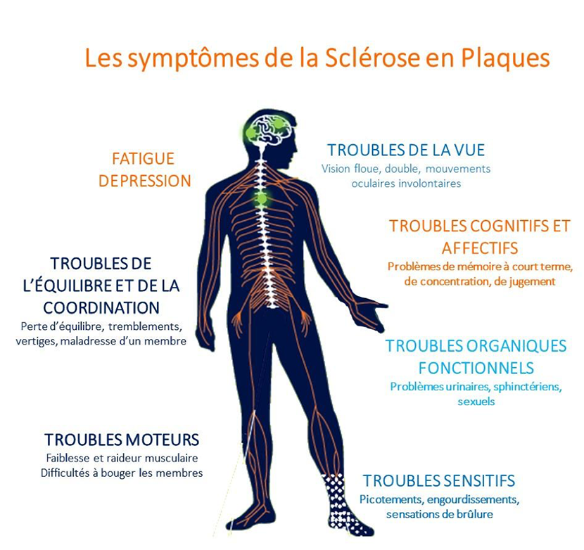 What are the symptoms of multiple sclerosis (MS)? | Paris Brain Institute