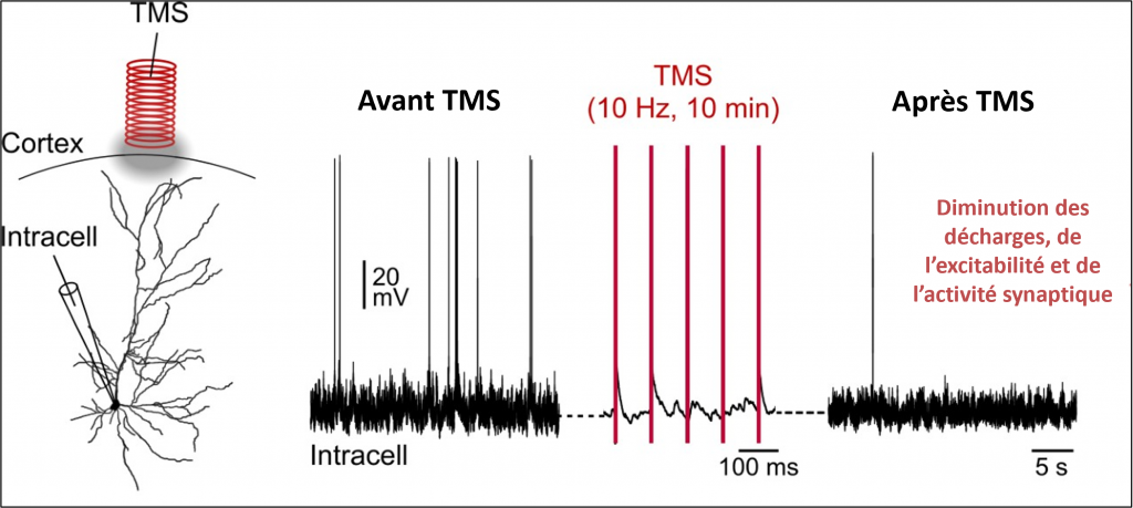 Transcranial Magnetic Stimulation, what happens in the brain? | Paris ...