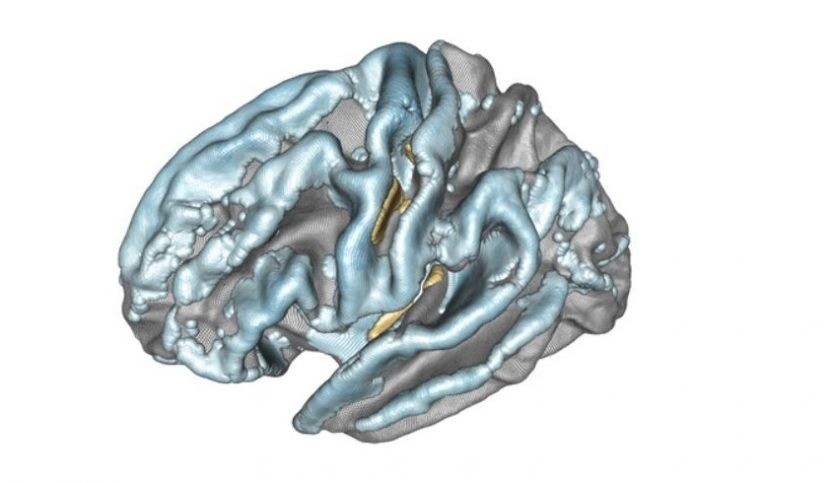 ARAMIS: Machine learning and data science for brain disorders | Paris ...