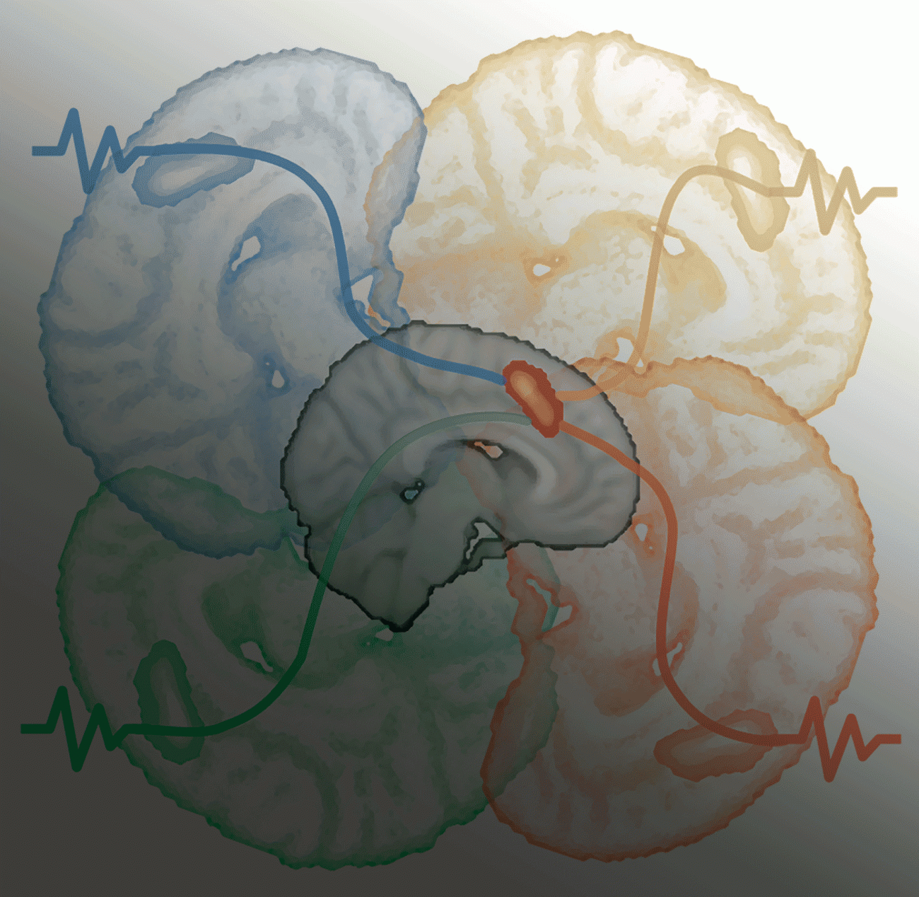 Organization of research | Paris Brain Institute