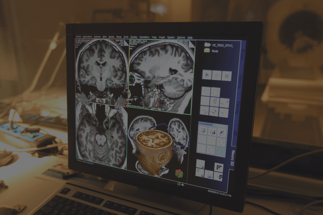 Organization of research | Paris Brain Institute