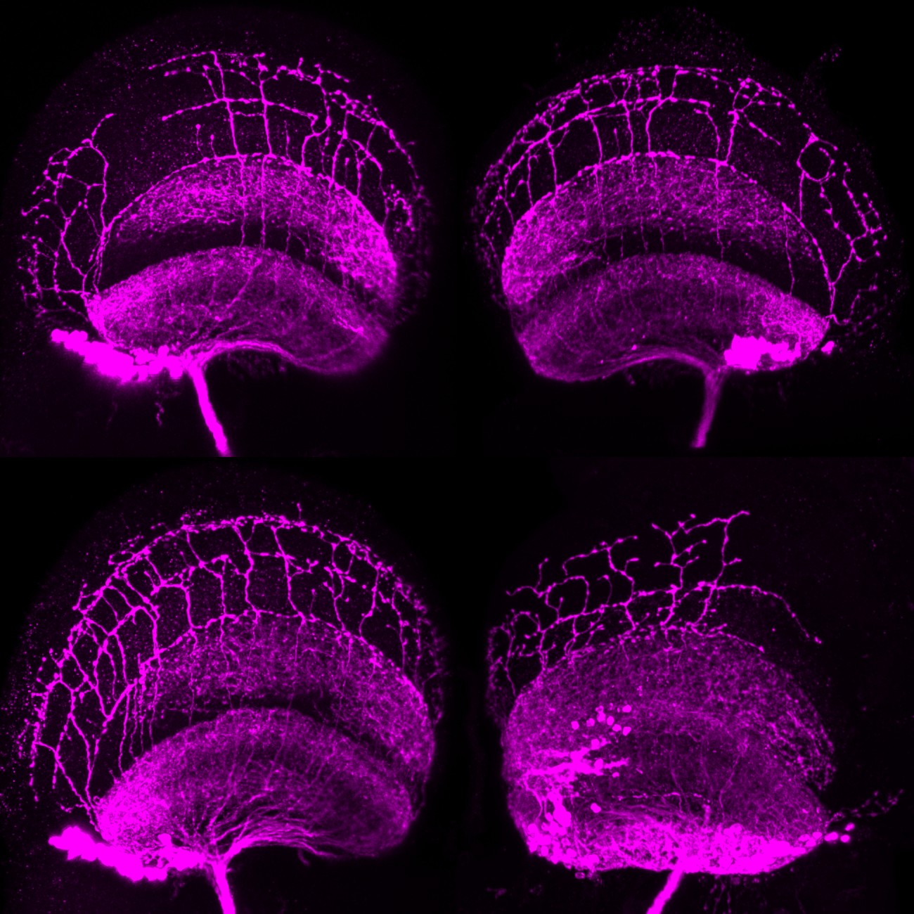 The stochastic aspect of brain development | Paris Brain Institute The stochastic aspect of brain development | Paris Brain Institute
