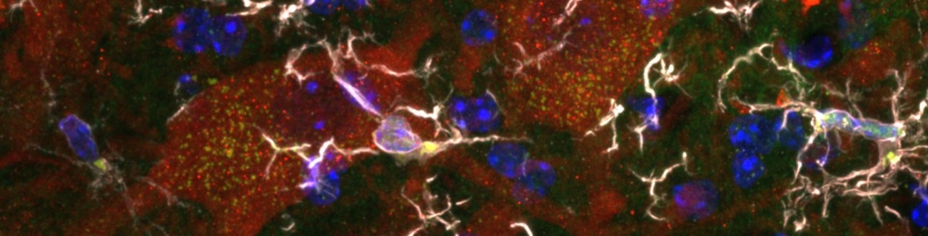 Ultrasound show unexpected effects on motor neuron disease | Paris ...