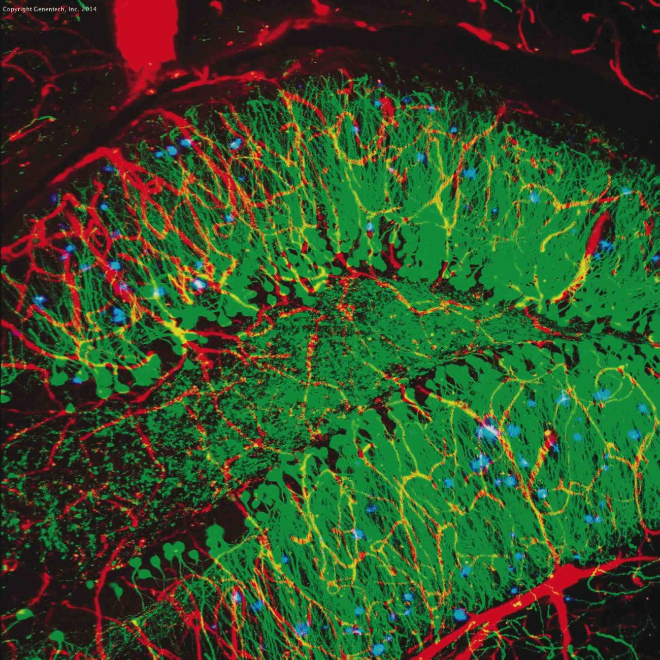 Computational modeling in neuroscience | Paris Brain Institute