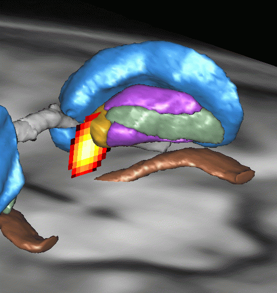 Brain scanning methods | Paris Brain Institute