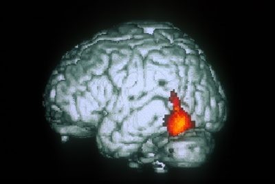 Mental Time Travel: A New Case of Autobiographical Hypermnesia | Paris ...