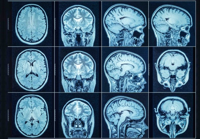 Understanding the Brain | Paris Brain Institute