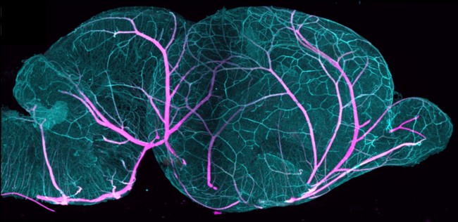 Origin of Lance-Adams Syndrome Finally Elucidated | Paris Brain Institute
